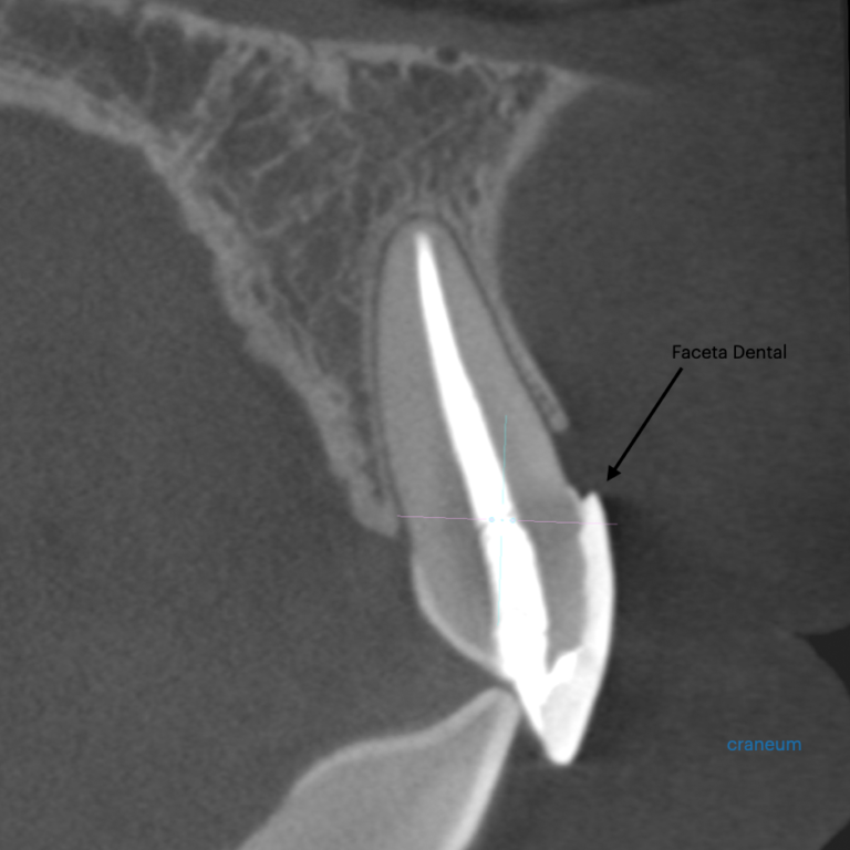 Craneum inova mais uma vez com o mais avançado tomógrafo do mundo - Craneum